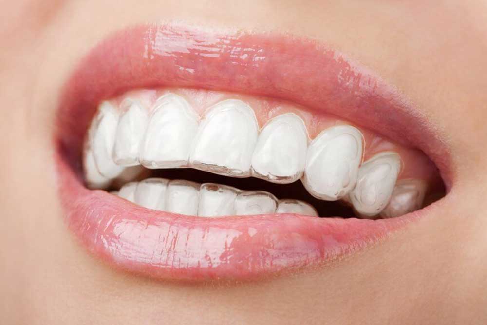 Home - TRI-STATE DENTAL