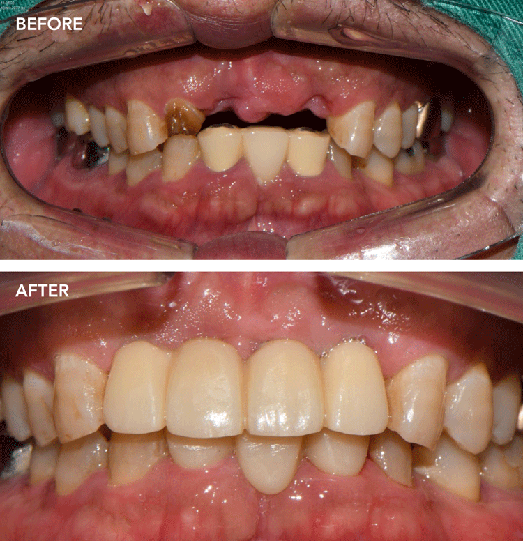 Before and After - TRI-STATE DENTAL